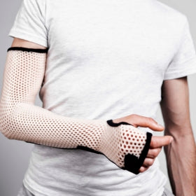 Orfit Classic, Soft – HPMS, Inc. The Therapy Connection